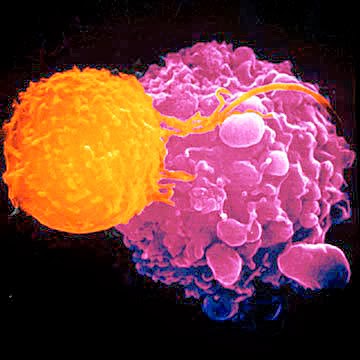 癌症新理論 － 染色體錯亂 - 科學，就是醬